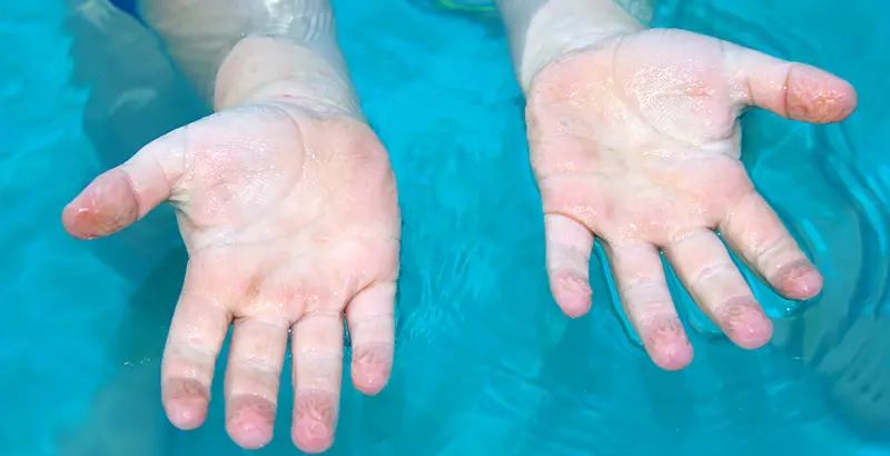 Waarom verschrompelen vingers in het water?