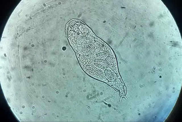 rotifer