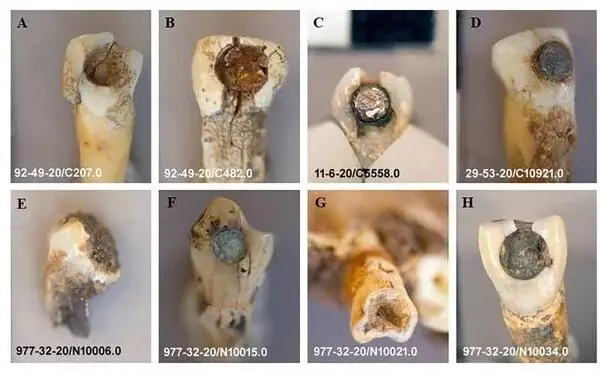 mayan teeth