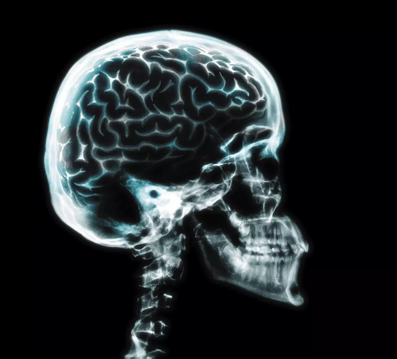 Le rétrécissement du cerveau ne s'est pas produit il y a 3 000 ans 9359_2